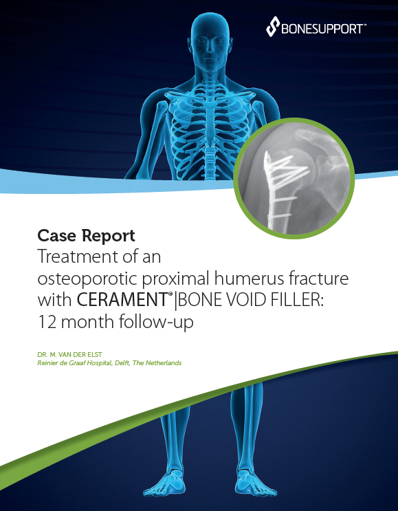 Publications and Resources - BONESUPPORT