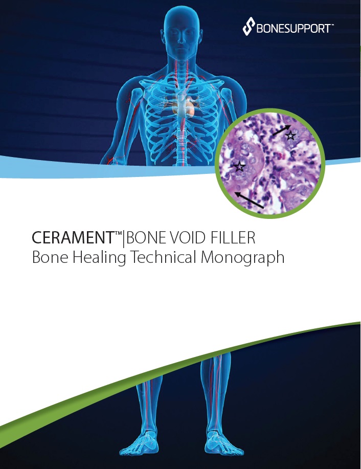 REVISION ARTHROPLASTY: WHY USE CERAMENT - BONESUPPORT