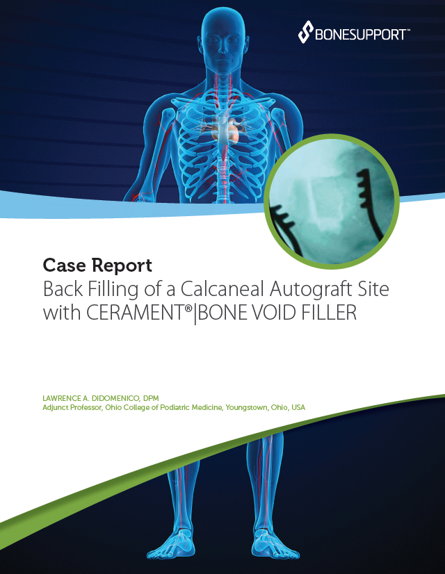 Publications and Resources - BONESUPPORT