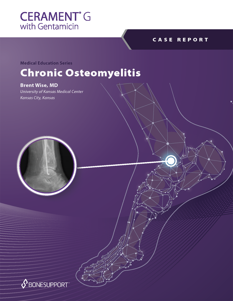 Chronic osteomyelitis - BONESUPPORT