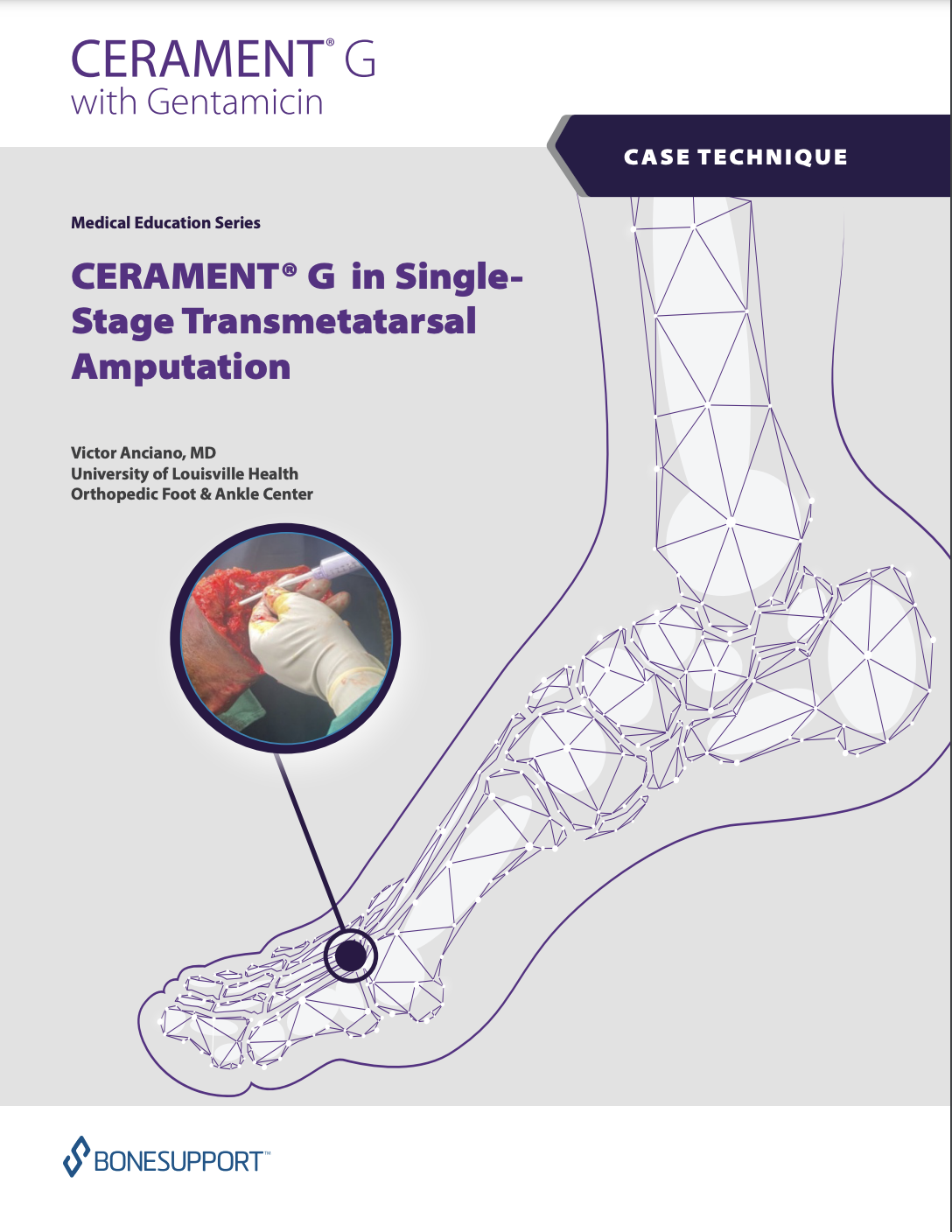 Diabetic Foot - BONESUPPORT