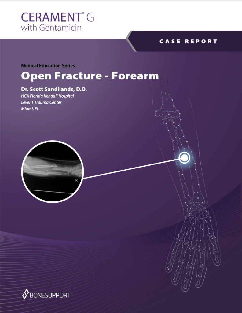 Open Fracture - BONESUPPORT