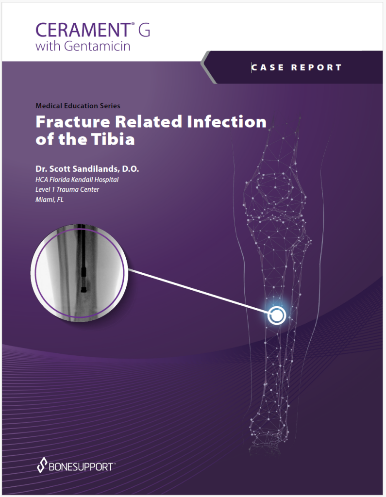 Fracture-Related Infection - BONESUPPORT