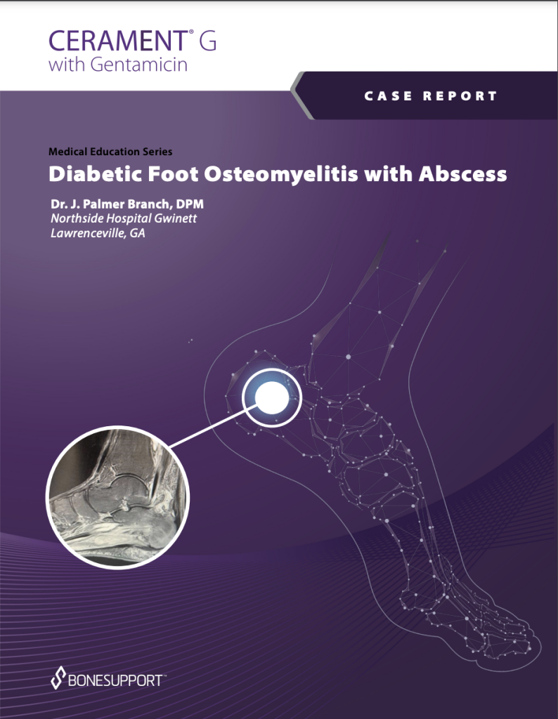 Diabetic Foot - BONESUPPORT